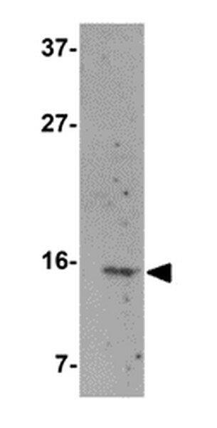 Anti-Norrin Antibody | ABS440